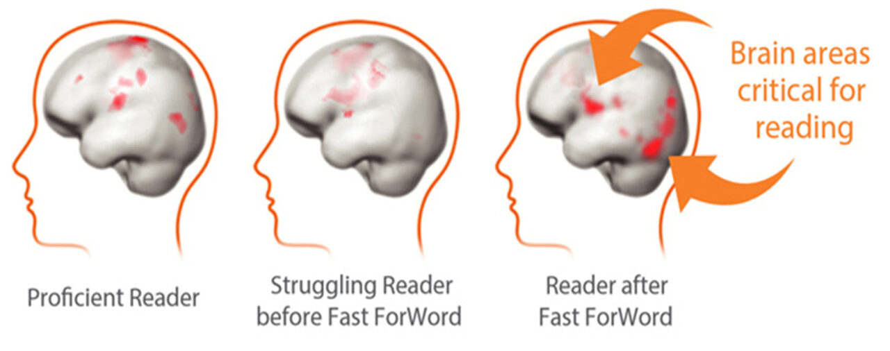 Fast ForWord - Auditory Processing Center